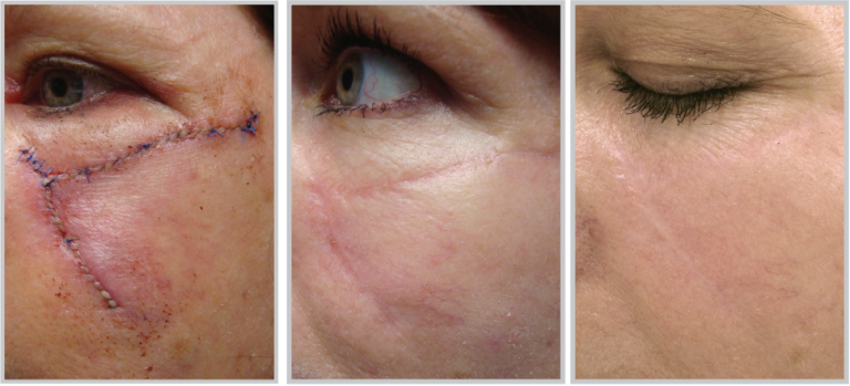 Laser - Ageless Anatomy Med Spa